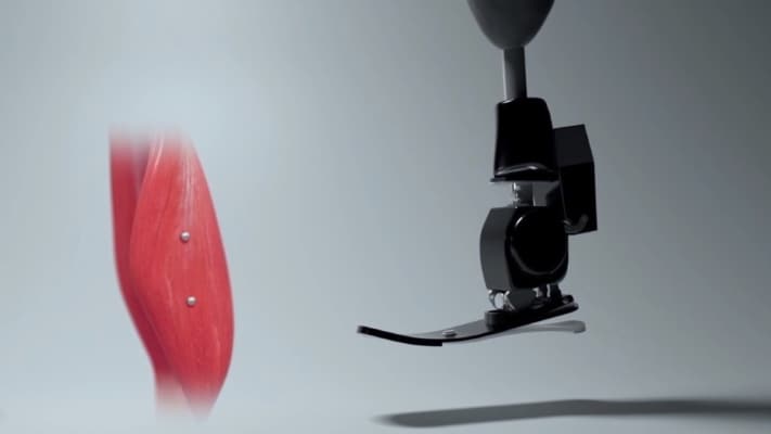 Magnetic beads inside the body could improve control of bionic limbs ...