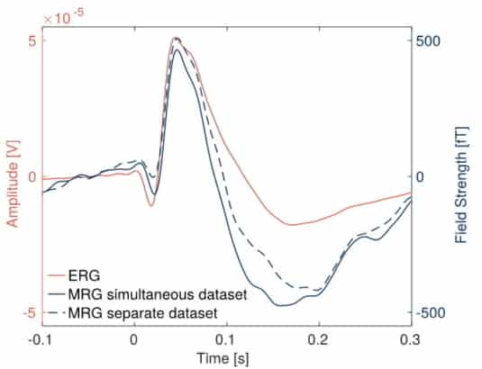 Quantum sensors could revolutionize retinal diagnostic procedures ...