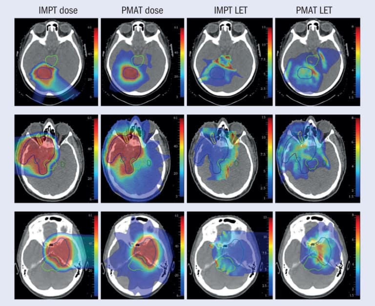 Proton arc therapy: do we need it; can we deliver it? – Physics World