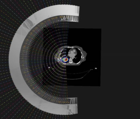 Proton arc therapy: do we need it; can we deliver it? – Physics World