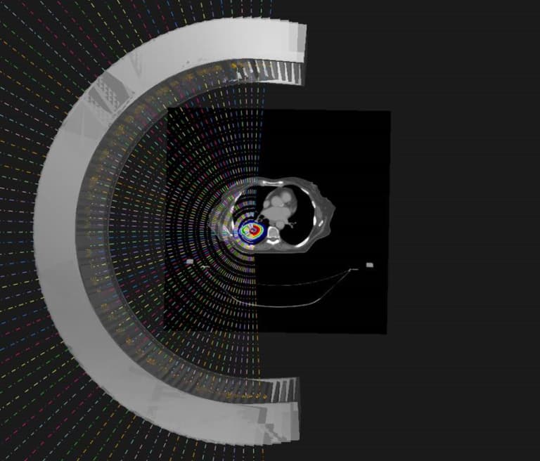 Proton arc therapy: do we need it; can we deliver it? – Physics World