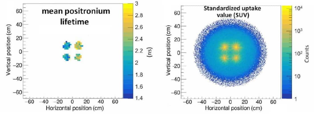First positronium image recorded during a PET scan – Physics World