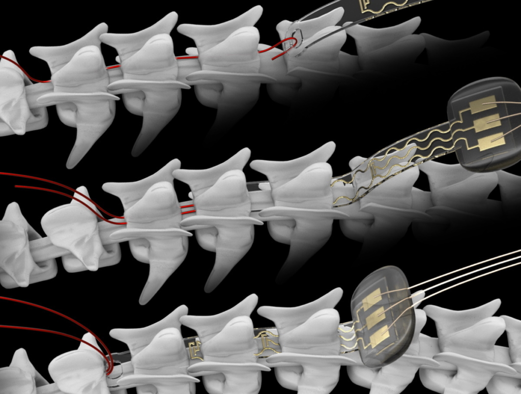 Controlling cells with sound: scientists pioneer sonogenetics – Physics ...