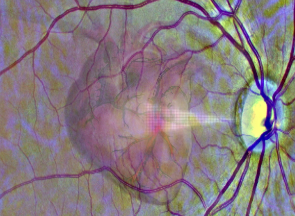 Machine learning and advanced imaging improve prediction of heart ...