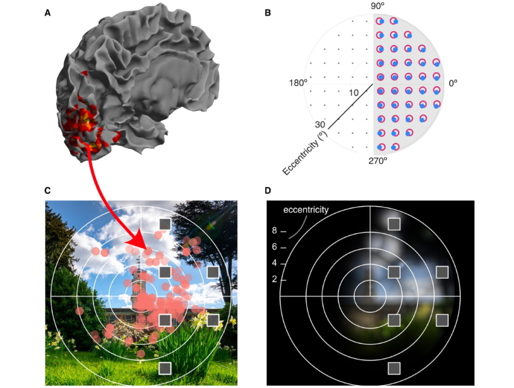 Multimodal MRI reveals brain areas that can still ‘see’ after a stroke ...