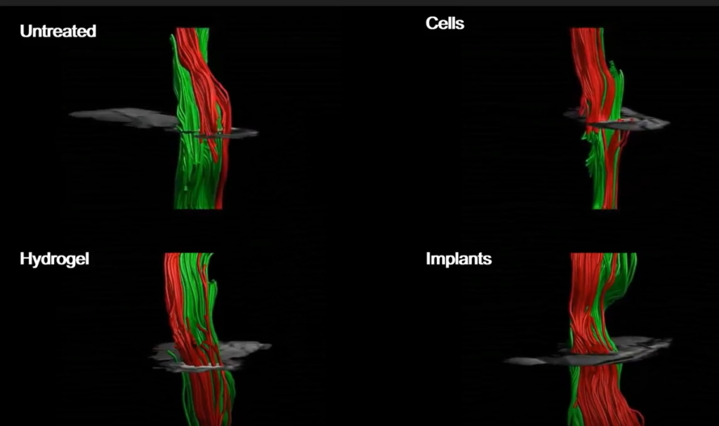 Engineered spinal cord implants restore movement to paralysed mice ...