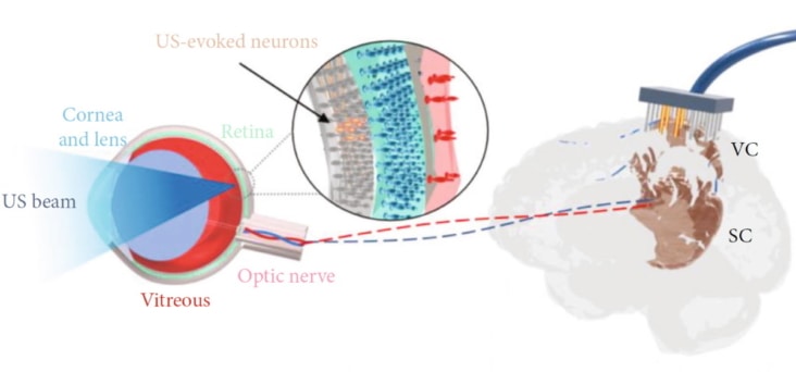 Ultrasound beams activate neurons in the eye to help restore vision ...