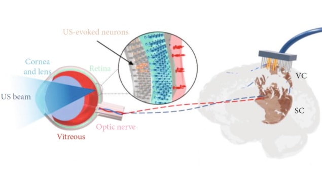 Flexible implant shows potential to restore vision after retinal ...