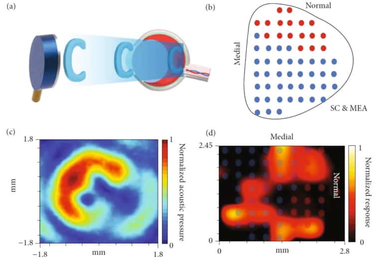 Ultrasound beams activate neurons in the eye to help restore vision ...