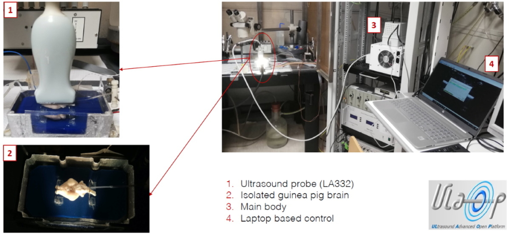 A window to the brain: ultrasound can open the BBB through a polymer ...