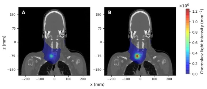 Cherenkov light could enable dosimetry of molecular radiation therapy ...