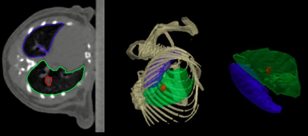 Focus on machine learning models in medical imaging – Physics World