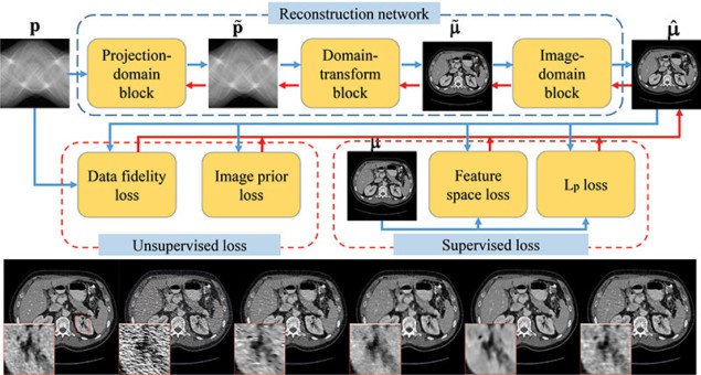 Incorporating deep learning into X-ray CT imaging – Physics World