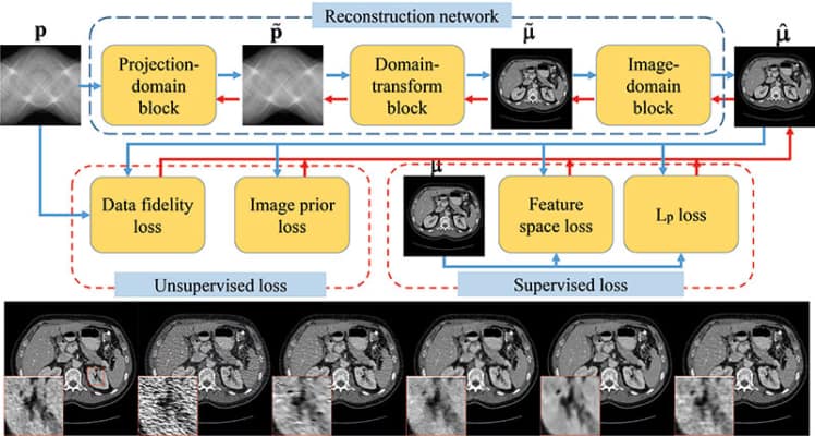 Incorporating deep learning into X-ray CT imaging – Physics World