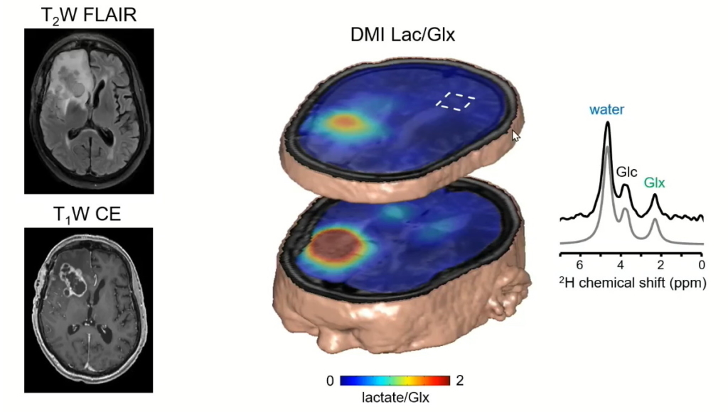 MRI's 'forgotten' contrast agent makes dramatic reappearance – Physics ...