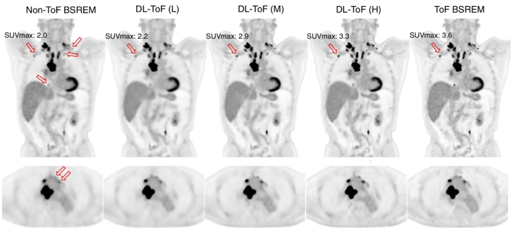 Nuclear medicine Archives – Physics World