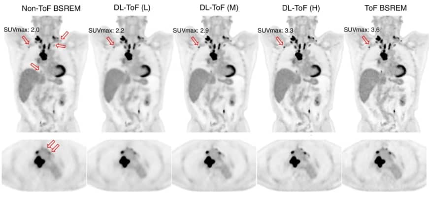 Nuclear medicine Archives – Physics World