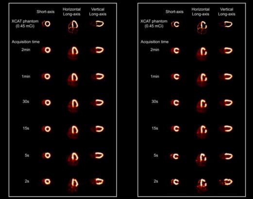 Advances in nuclear medicine technology reduce radiation exposure and ...
