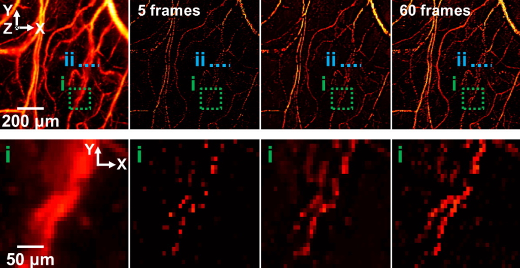 Photoacoustic imaging technique could reduce nerve damage during ...