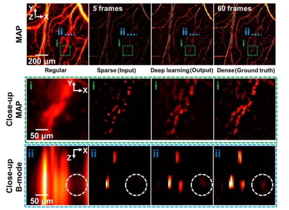 Deep learning accelerates super-resolution photoacoustic imaging ...
