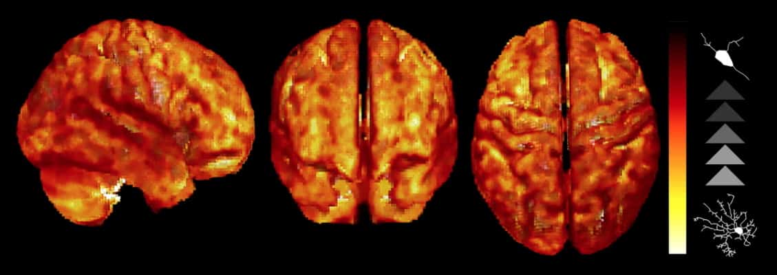 Researchers produce first in vivo images of brain inflammation using ...