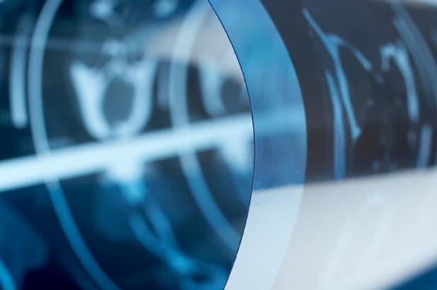 Helium ion beam therapy – Physics World