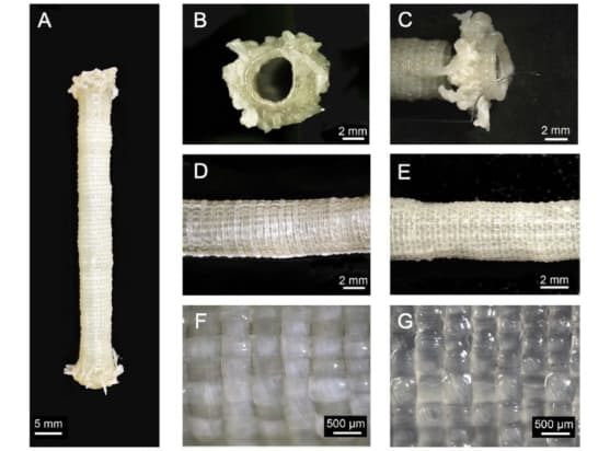 Vascular grafts created by weaving threads of amniotic membrane ...