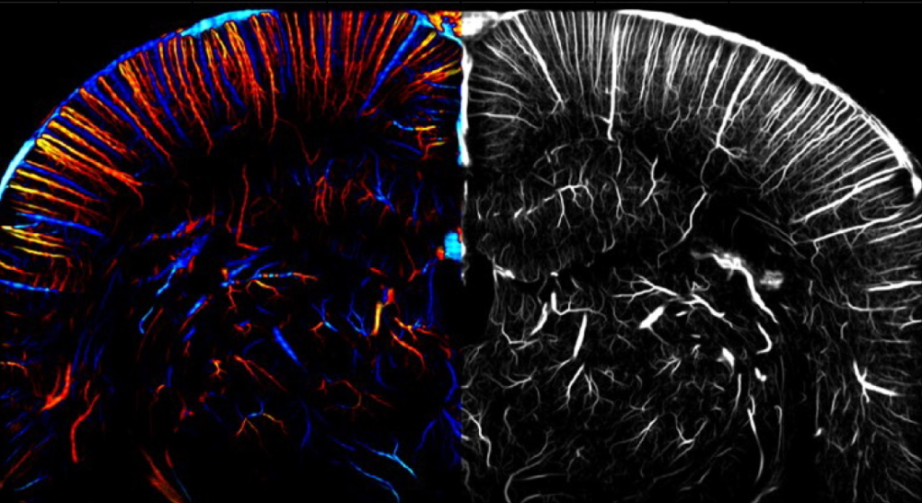High-resolution MRI enables direct imaging of neuronal activity ...