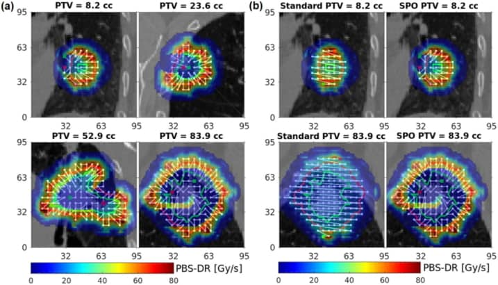 Optimized pencil-beam delivery patterns enhance FLASH proton therapy ...