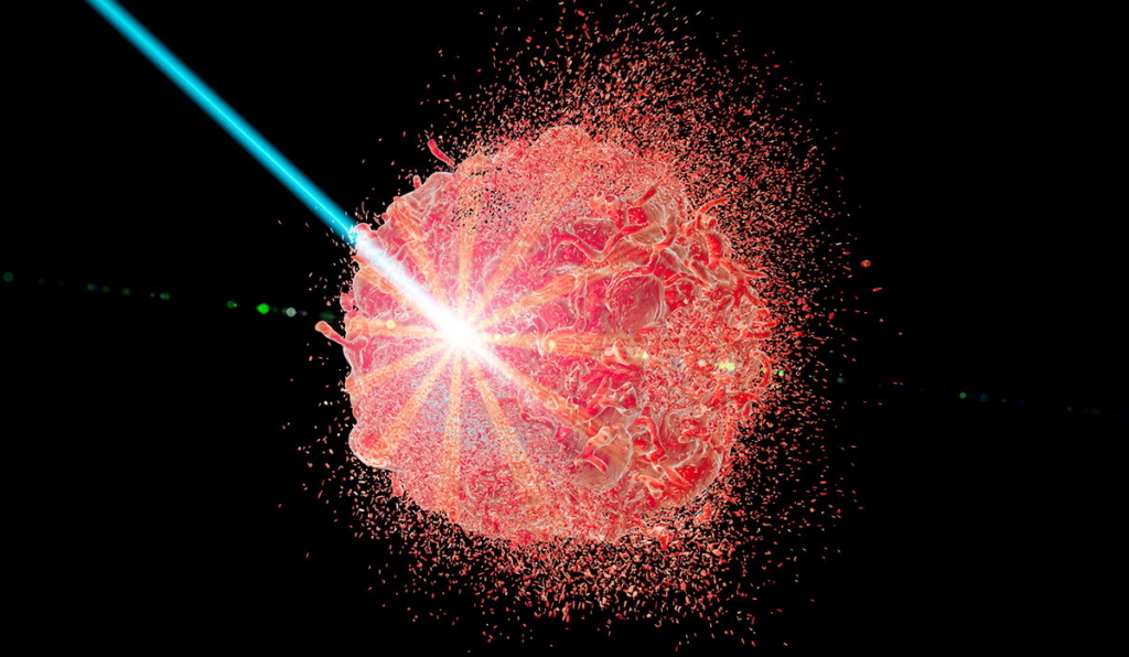 Photons, protons or electrons: which will bring FLASH radiotherapy to ...
