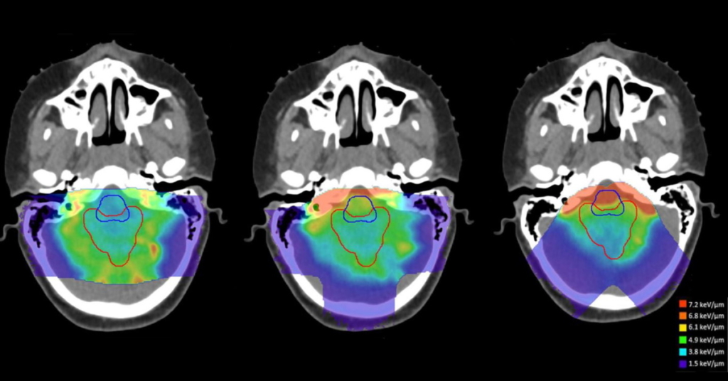Proton CT or dual-energy X-ray CT: which wins out for proton planning ...