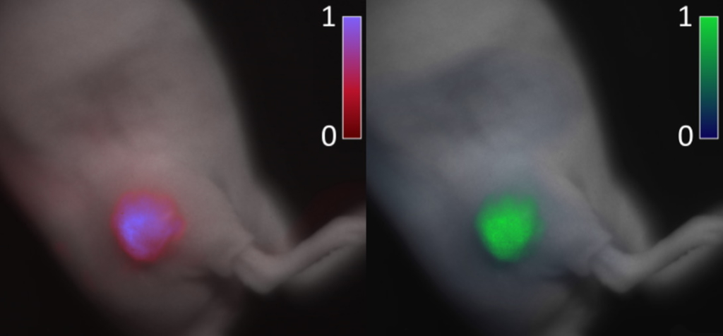 Multispectral infrared imaging improves guidance of cancer surgery ...