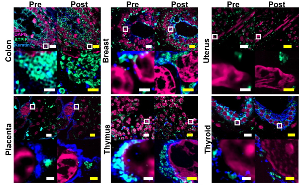 Expansion microscopy enables nanoimaging with a conventional microscope ...