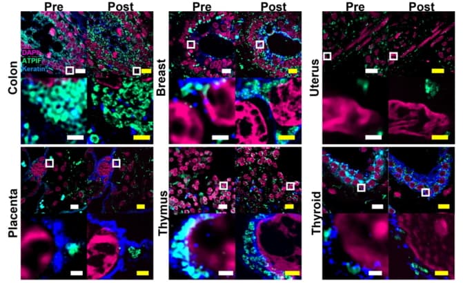Expansion microscopy enables nanoimaging with a conventional microscope ...
