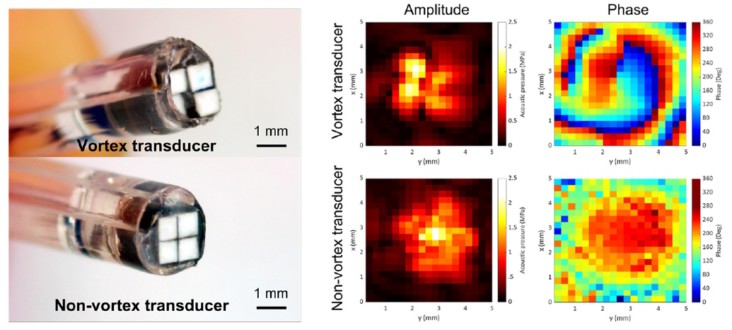 Vortex ultrasound tool breaks down blood clots in the brain – Physics World