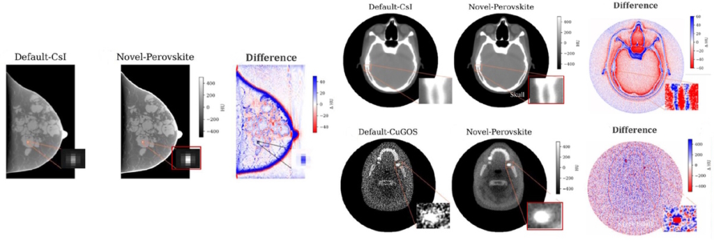 Could next-generation perovskite detectors improve clinical X-ray ...