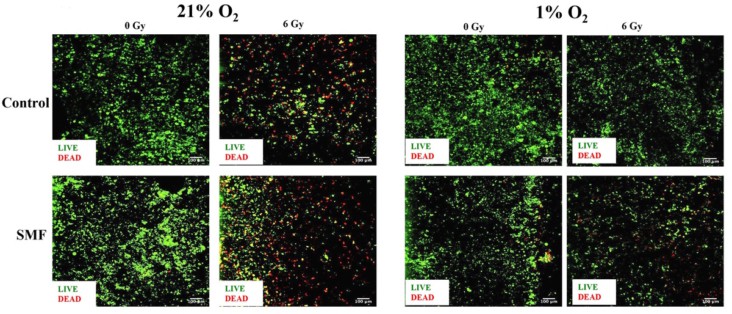 3D cancer model reveals how a static magnetic field can enhance ...