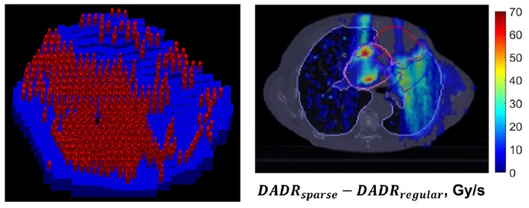 Patient-specific ridge filters enable conformal FLASH proton therapy ...
