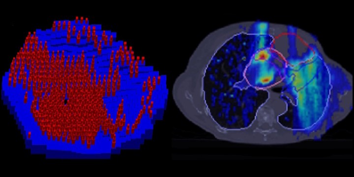Particle therapy Archives – Physics World