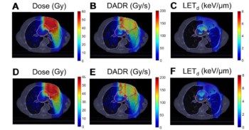 Patient-specific ridge filters enable conformal FLASH proton therapy ...