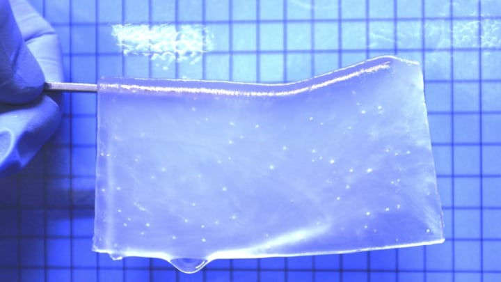 Hydrogel to repair heart proves safe to inject in humans – Physics World