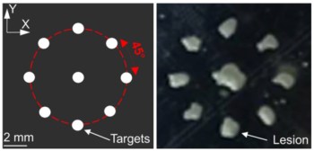 Image-guided HIFU system shows potential for clinical treatments ...