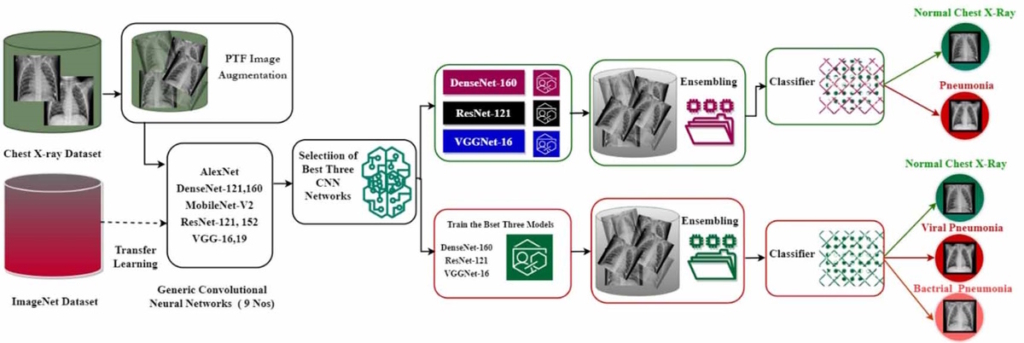 Machine-learning framework classifies pneumonia on chest X-rays ...