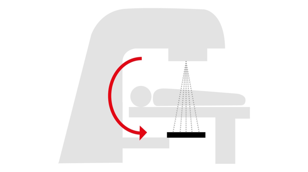 Reimagining patient QA: 3D EPID dosimetry leverages Monte Carlo calculations – Physics World