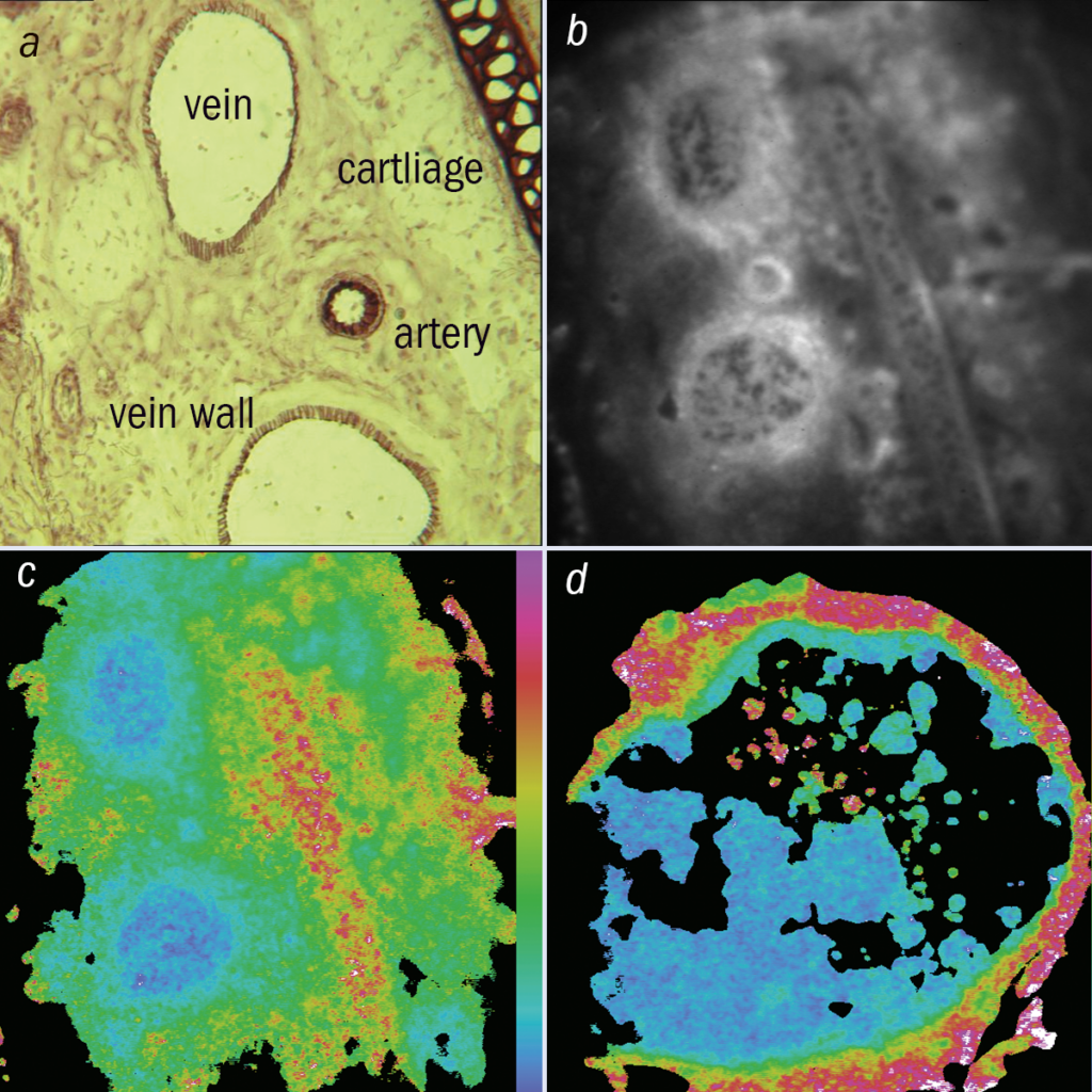 Biomedical optics – Physics World