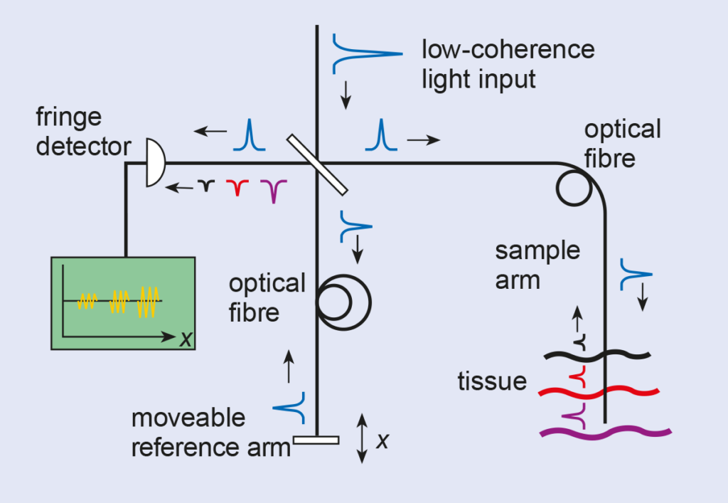 Biomedical optics – Physics World