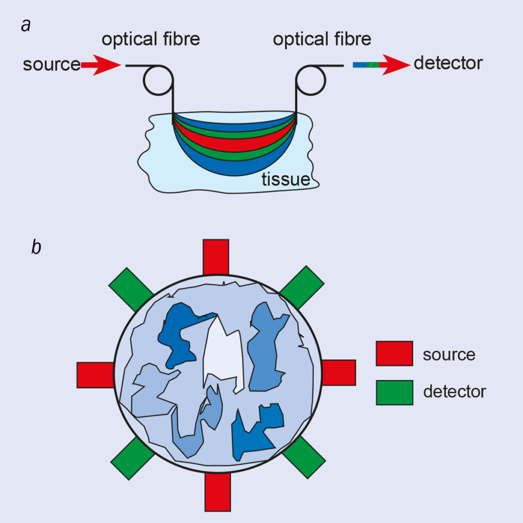 Biomedical optics – Physics World
