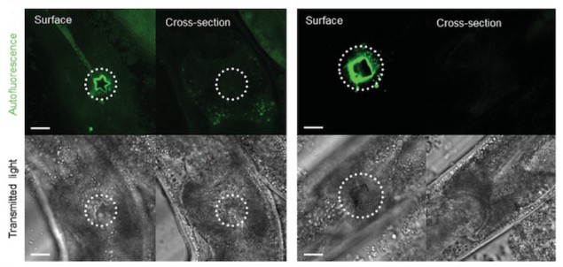 Laser-printed electronics could create next-generation medical implants ...
