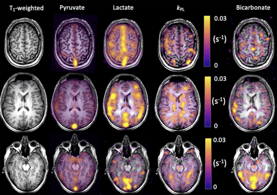 Dynamic nuclear polarization: how a technique from particle physics is ...