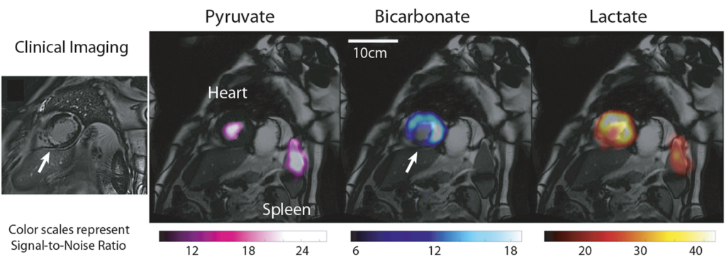 Dynamic nuclear polarization: how a technique from particle physics is ...